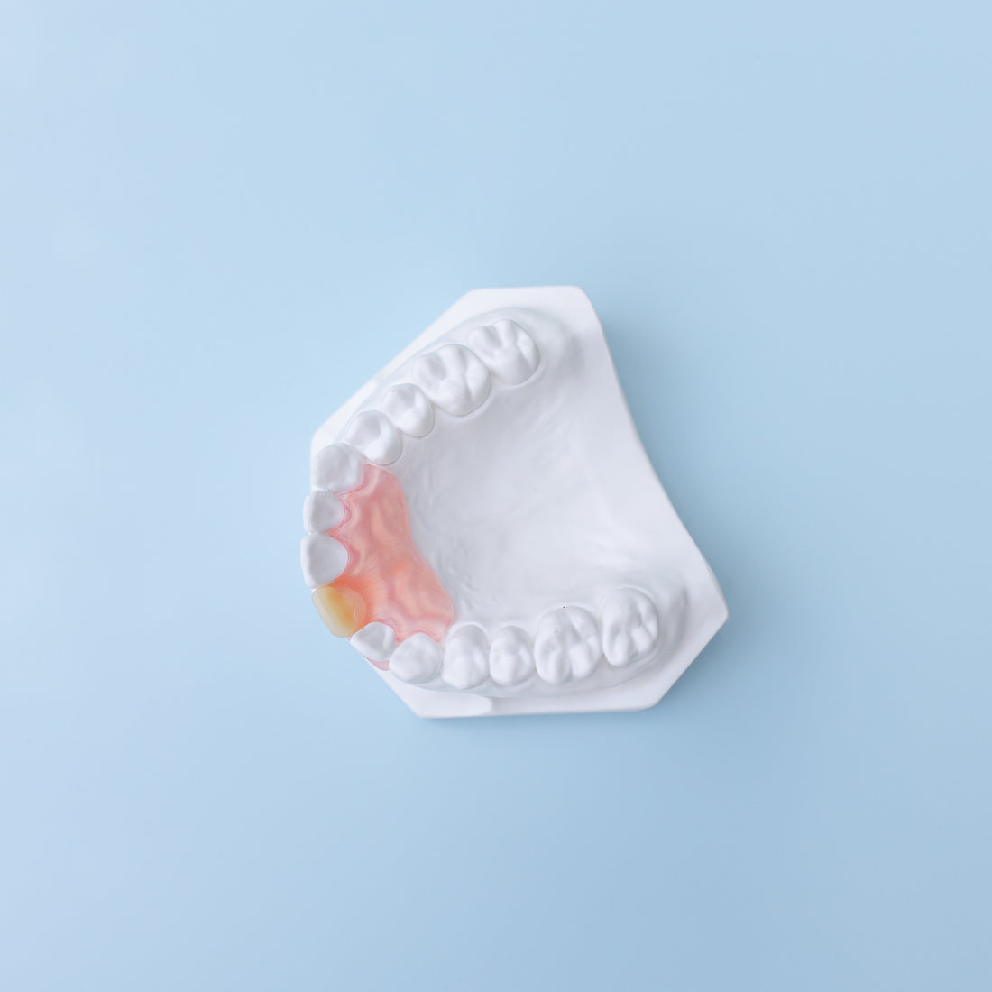 UNILATERAL FLEXIBLE PARTIAL – Dental Tech Direct